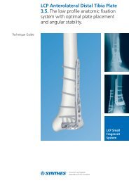 LCP DISTAL HUMERUS PLATES.pdf - Osteosyntese