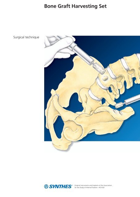 Bone Graft Harvesting Set - Synthes