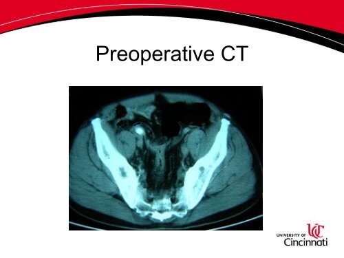 Preoperative CT