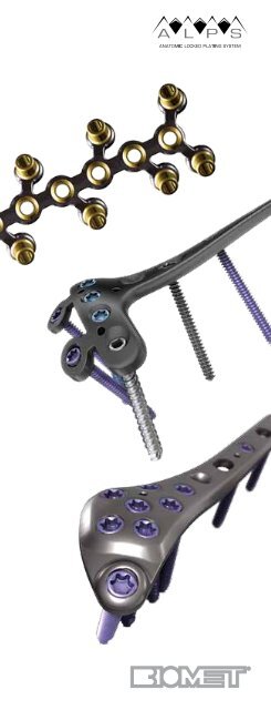 (A.L.P.S) - BMET0041.0 - Biomet