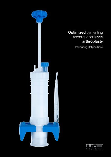Optimized cementing technique for knee arthroplasty - Biomet