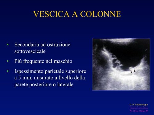 VESCICA A COLONNE• Seco