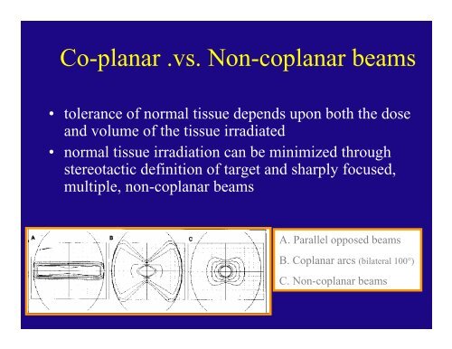 Non Coplanar Beams Definition - The Best Picture Of Beam