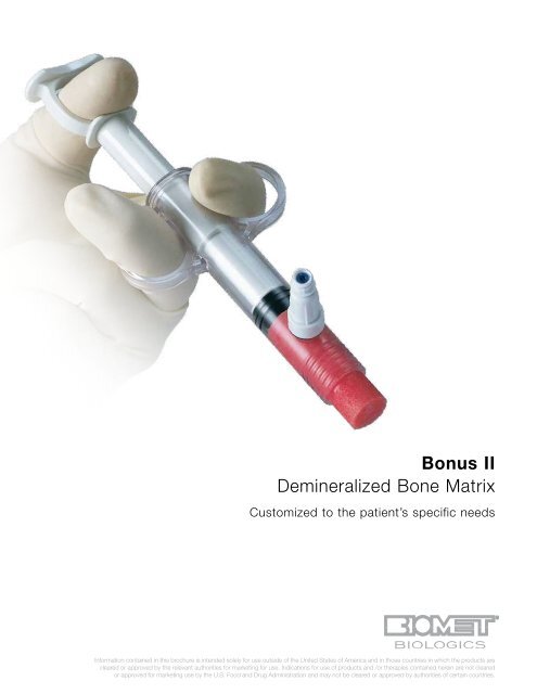 Bonus II Demineralized Bone Matrix Customized to the ... - Biomet