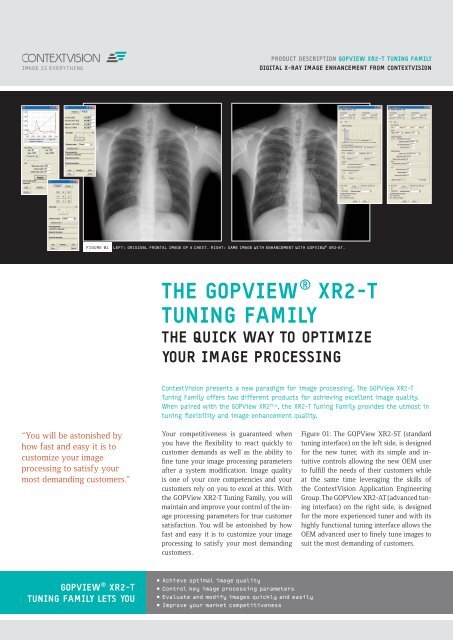 tHe GoPView® Xr2-t tuninG Family - ContextVision