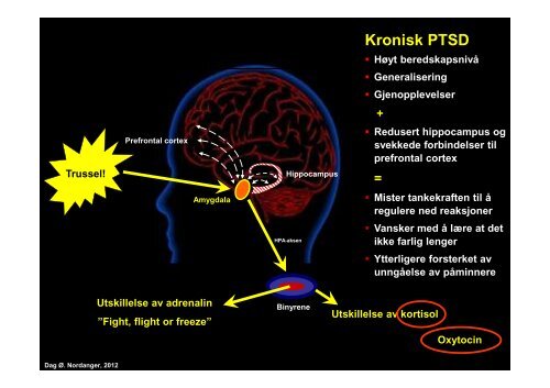 Trussel!Prefrontal cortex
