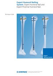 Expert HAN. Expert Hindfoot Arthrodesis Nail. - Synthes