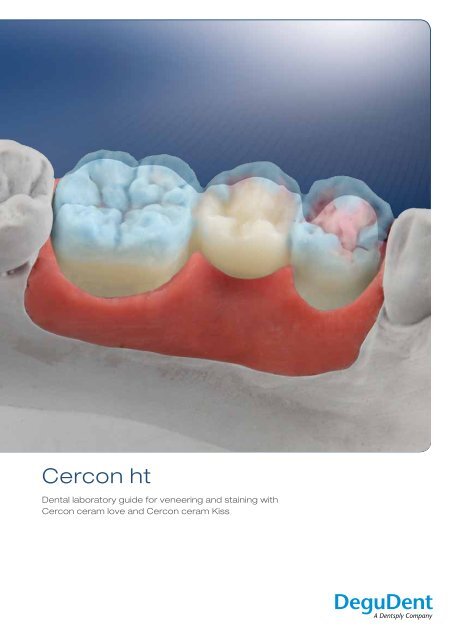 Cercon ht - DeguDent