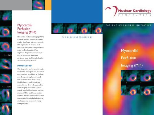 Myocardial Perfusion Imaging Brochure - American Society of ...