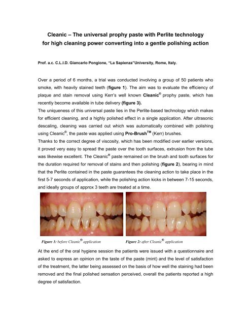 Cleanic – The universal prophy paste with Perlite ... - Kerr Hawe