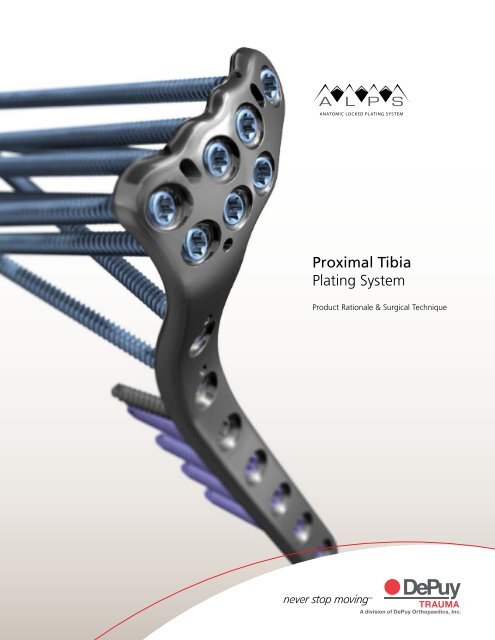 Proximal Tibia System Product Rationale & Surgical ... - Biomet