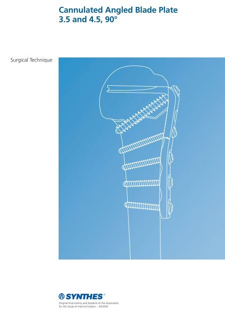 Cannulated Angled Blade Plate 3.5 and 4.5, 90° - Osteosyntese