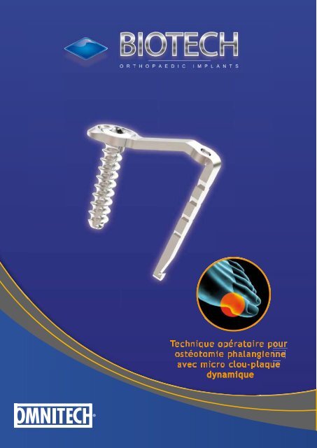 Omnitech Clou - Plaque A23 - Biotech ortho