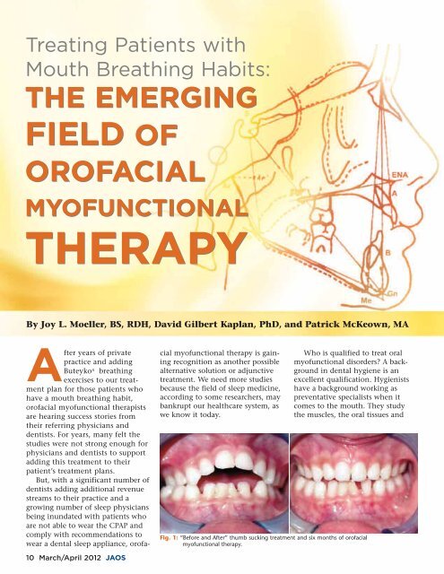 About Orofacial Myofunctional Therapy - Washington State Dental ...