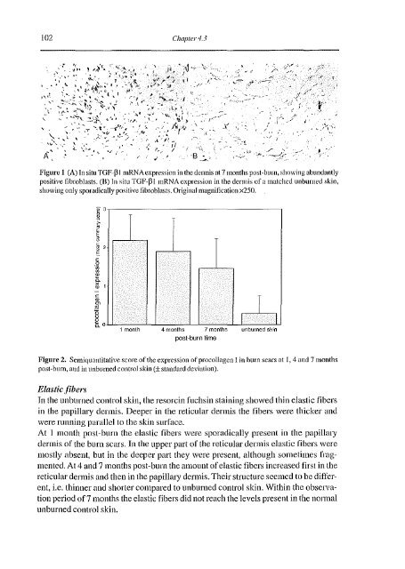 Epidermal-dermal crosstalk during burn wound scar maturation