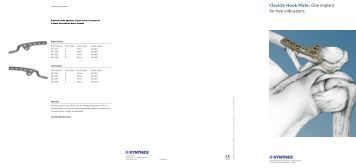 tifix ® AC-Hakenplatte tifix® AC hook plate - litos