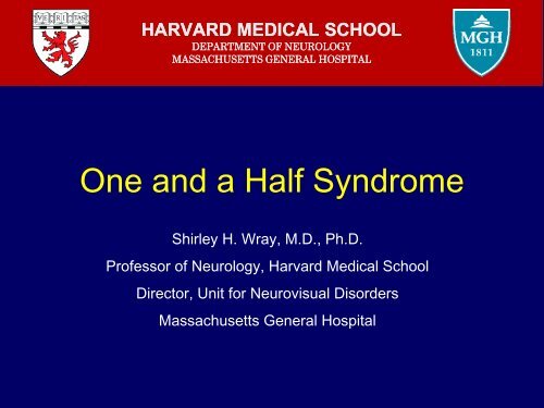 Horizontal Gaze Palsy