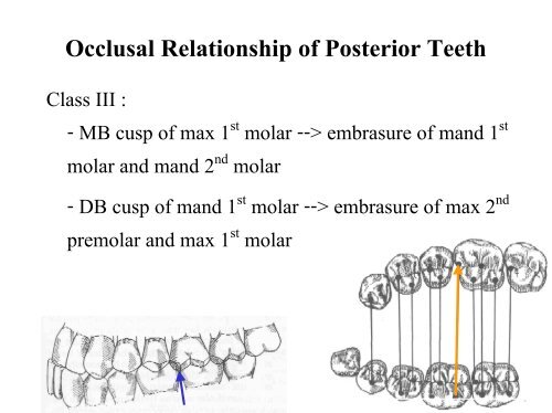 Occlusal