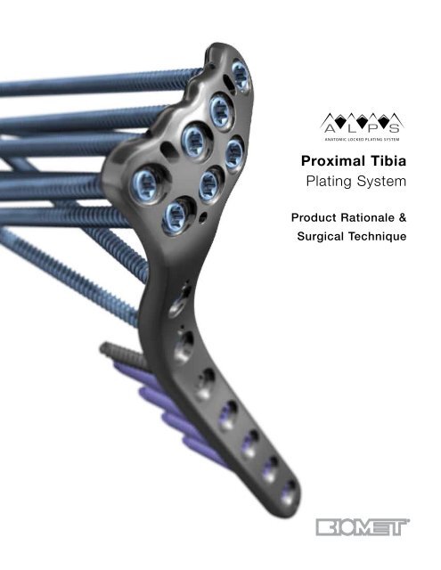Proximal Tibia Plating System Product Rationale & Surgical ... - Biomet