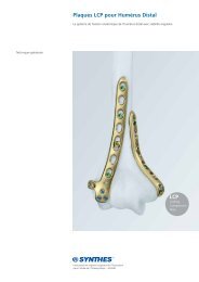 LCP Low Bend Medial Distal Tibia Plates 3.5 mm - Synthes