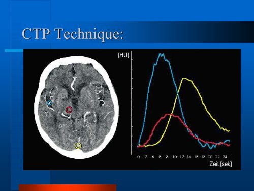 CTP Tech