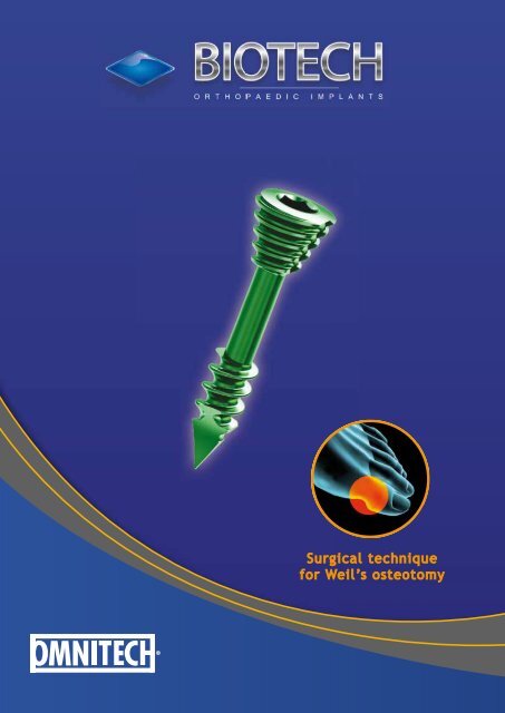 Surgical technique for Weil's osteotomy - Biotech ortho