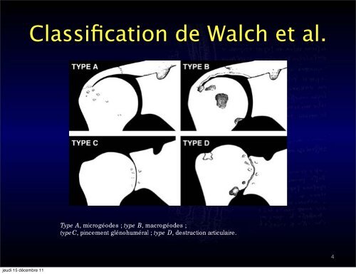 Classification de Walch e