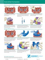 Closed and Open Tray Impressions - Zimmer Dental