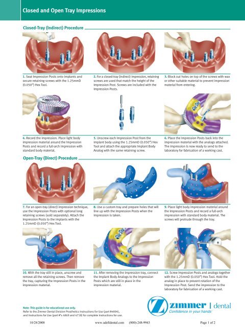 Zimmer Spline Impression - Udell dental laboratory