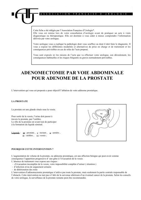 AdÃ©nomectomie prostatique - Urofrance