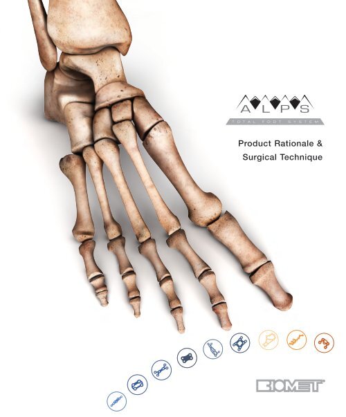 A.L.P.S. Total Foot System Product Rationale & Surgical ... - Biomet