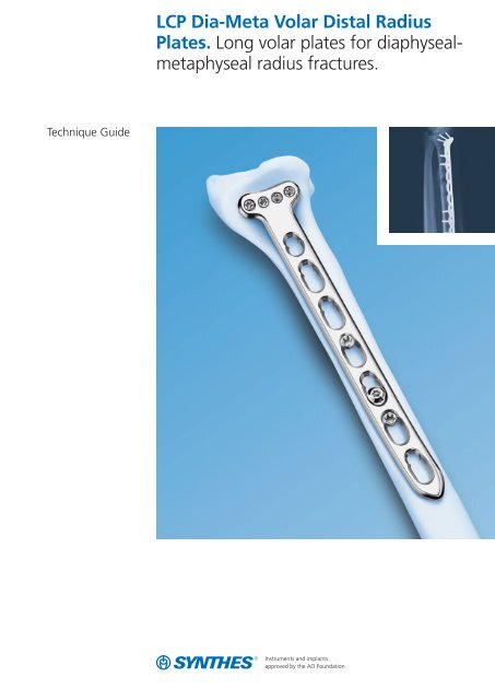 LCP Dia-Meta Volar Distal Radius Plates - Synthes