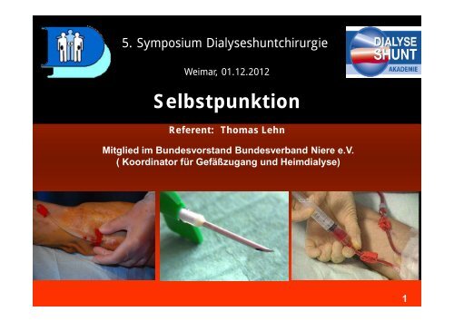 Selbstpunktion - Shunt