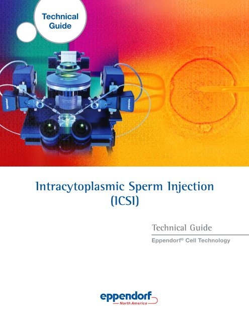 Intracytoplasmic Sperm Injection (ICSI) - Eppendorf
