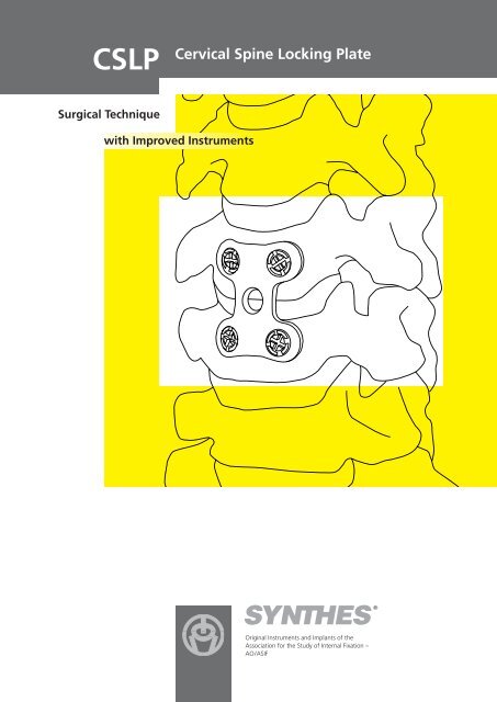 Cervical Spine Locking Plate