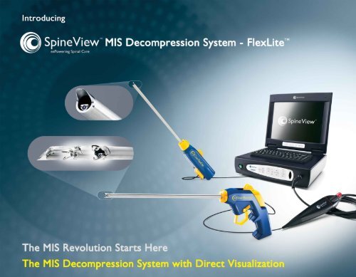 MIS Decompression System - SpineView
