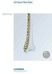 LCP Low Bend Medial Distal Tibia Plates 3.5 mm - Synthes