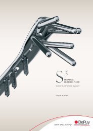 GTS Surgical Technique - Biomet