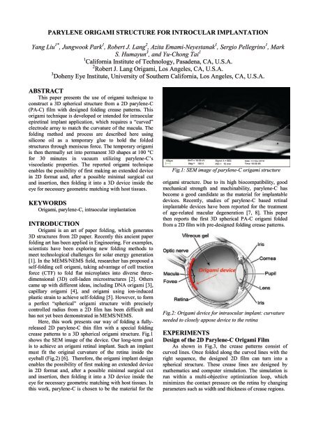 Parylene Origami Structure for Intraocular Implantation