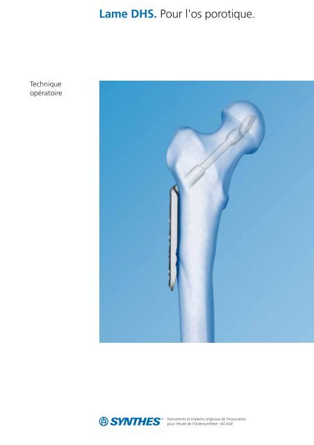 DHS Blade - Technique opÃ©ratoire.pdf - Synthes