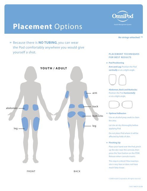Omnipod Placement Sheet - Insulet Corporation Omnipod Placement Sheet - Insulet Corporation
