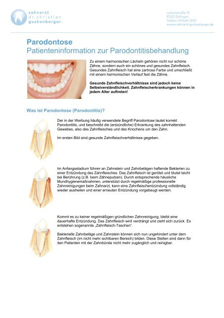 Parodontose Patienteninformation zur Parodontitisbehandlung