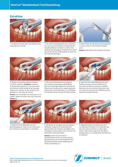 Extraktion - Zimmer Dental