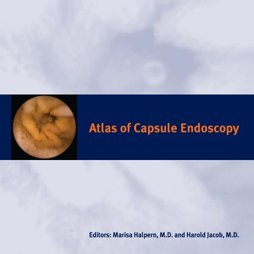 capsule experience - MG Lorenzatto