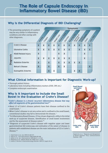 The Role of Capsule Endoscopy in Inflammatory Bowel Disease (IBD)