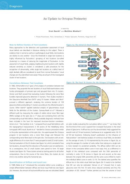 An Update to Octopus Perimetry - Ophthalmology