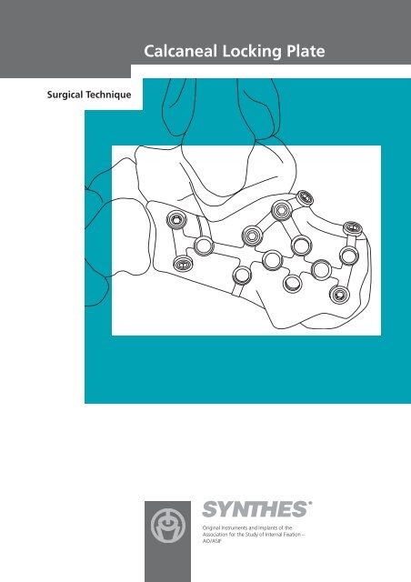 Calcaneal Locking Plate