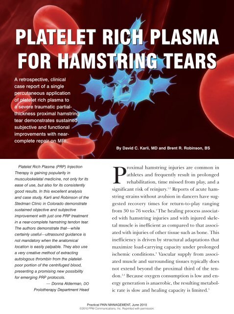 Platelet Rich Plasma for Hamstring Tears - Prolotherapy