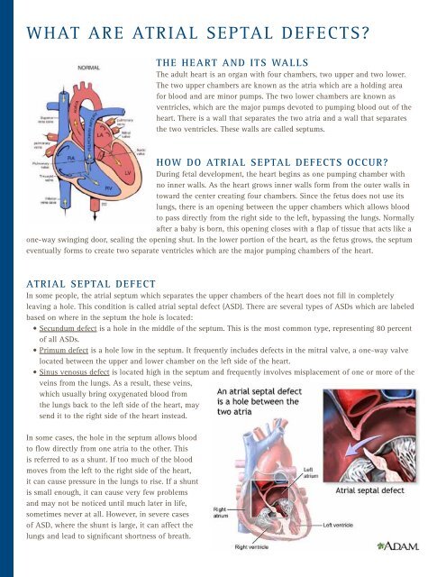 Atrial Septal Defect Types