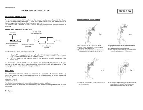 Transnasal Lacrimal Stent Information - FCI Ophthalmics